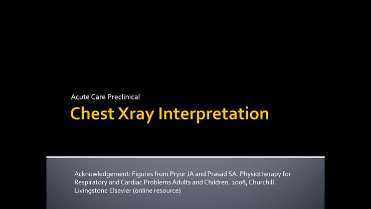 Chest x ray interpretation