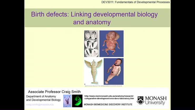 DEV3011_CL_S1_Birth Defects