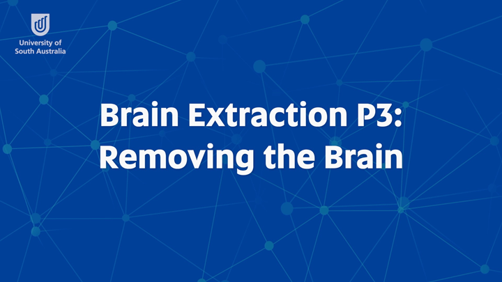 12_Brain extraction from a donated specimen: Dr Arjun Burlakoti and Dr ...
