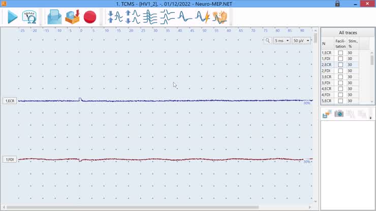 MEGA-TMS Trace Viewing Options